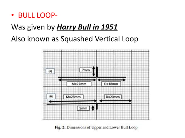 Loops In Orthodontics T Loop Bull Loop Vertical Loop Mushroom Loop Stop Loop Pptx Dental