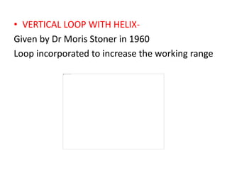 LOOPS in orthodontics t loop bull loop vertical loop mushroom loop stop ...