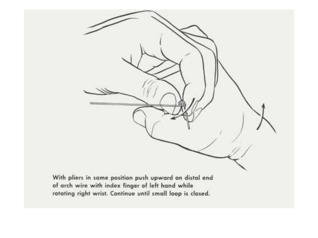 Loops In Orthodontics T Loop Bull Loop Vertical Loop Mushroom Loop Stop Loop Pptx Dental