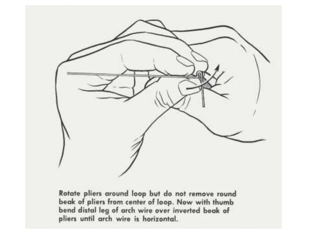 Loops In Orthodontics T Loop Bull Loop Vertical Loop Mushroom Loop Stop