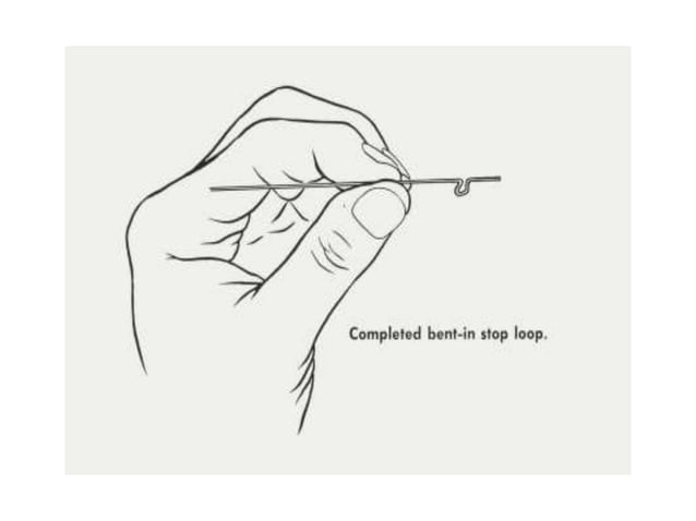 Loops In Orthodontics T Loop Bull Loop Vertical Loop Mushroom Loop Stop Loop Pptx Dental
