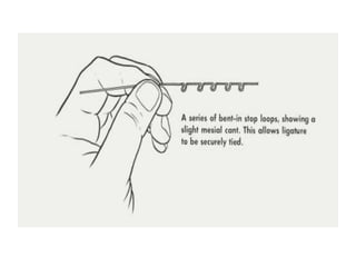 LOOPS in orthodontics t loop bull loop vertical loop mushroom loop stop ...