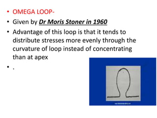 LOOPS in orthodontics t loop bull loop vertical loop mushroom loop stop loop | PPTX | Dental ...