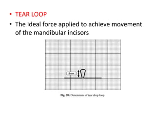 LOOPS in orthodontics t loop bull loop vertical loop mushroom loop stop loop | PPTX