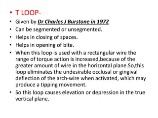 LOOPS in orthodontics t loop bull loop vertical loop mushroom loop stop ...