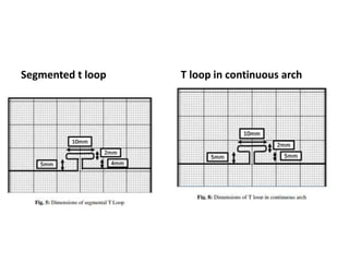 LOOPS in orthodontics t loop bull loop vertical loop mushroom loop stop loop | PPTX | Dental ...