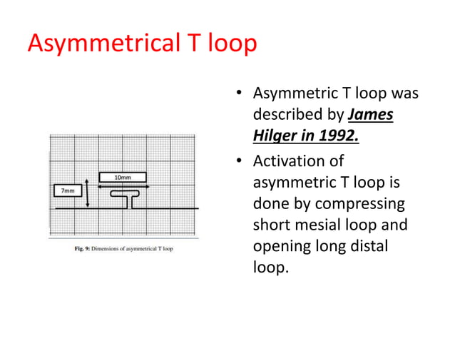 LOOPS in orthodontics t loop bull loop vertical loop mushroom loop stop loop | PPTX | Dental ...