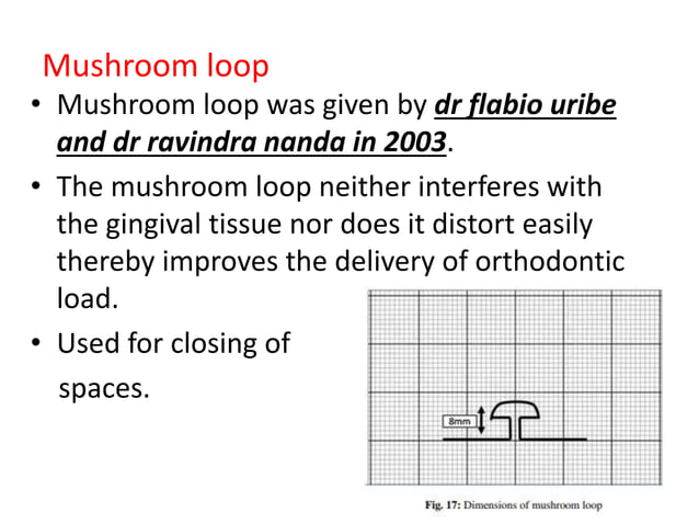 Loops In Orthodontics T Loop Bull Loop Vertical Loop Mushroom Loop Stop Loop Pptx Dental