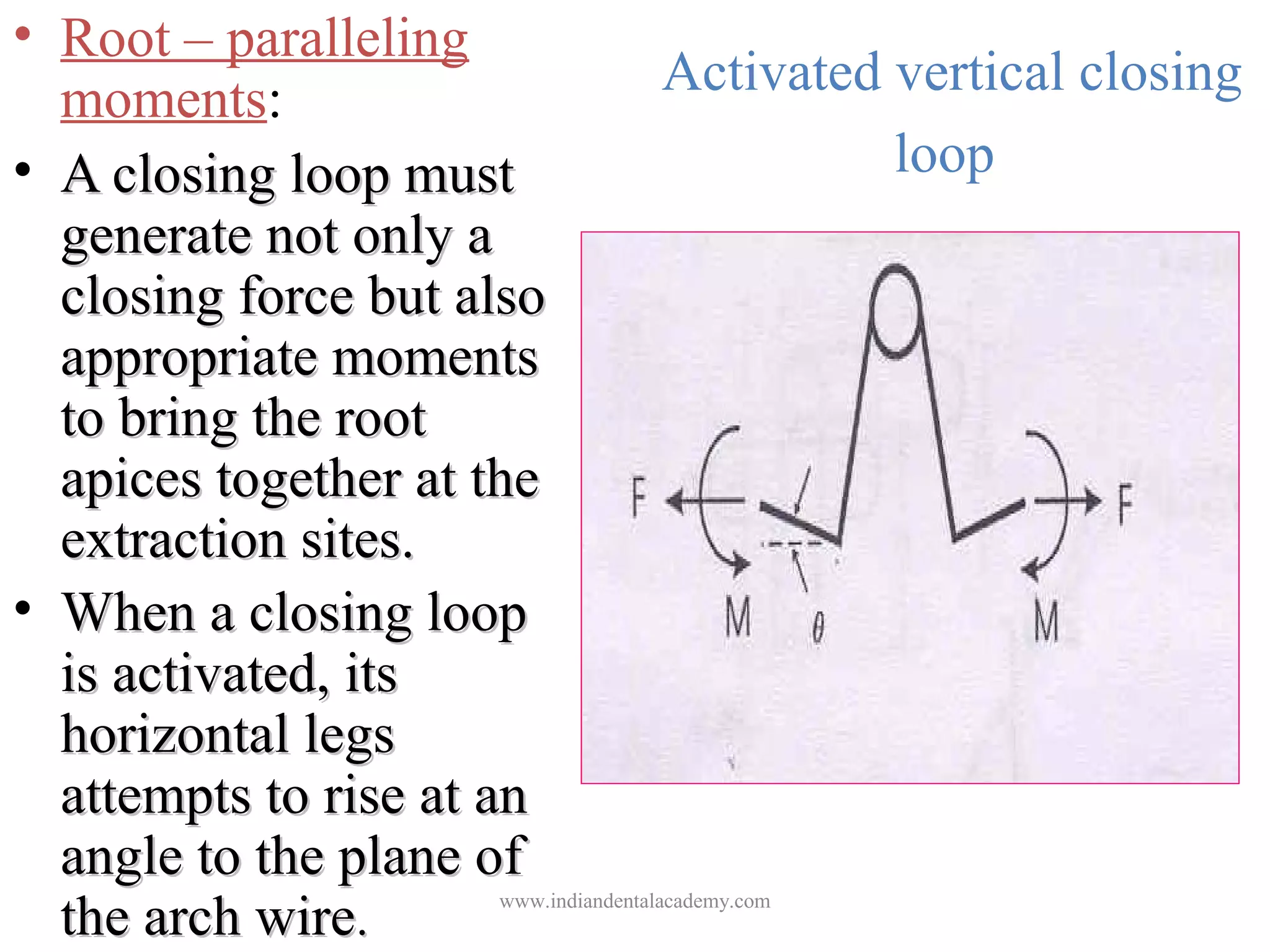 Loops in orthodontics /certified fixed orthodontic courses by Indian ...