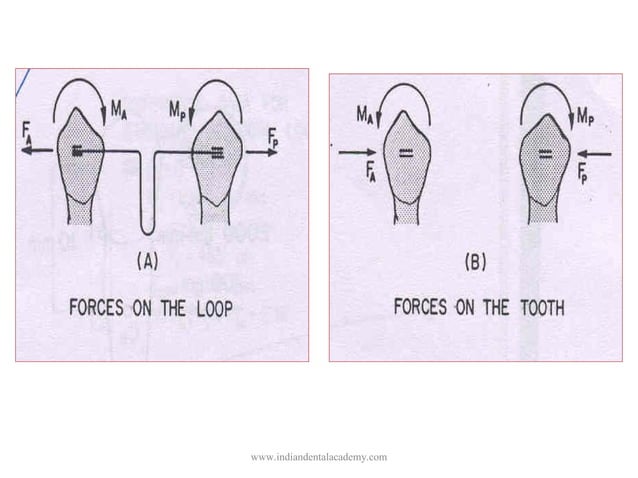 Loops in orthodontics /certified fixed orthodontic courses by Indian ...