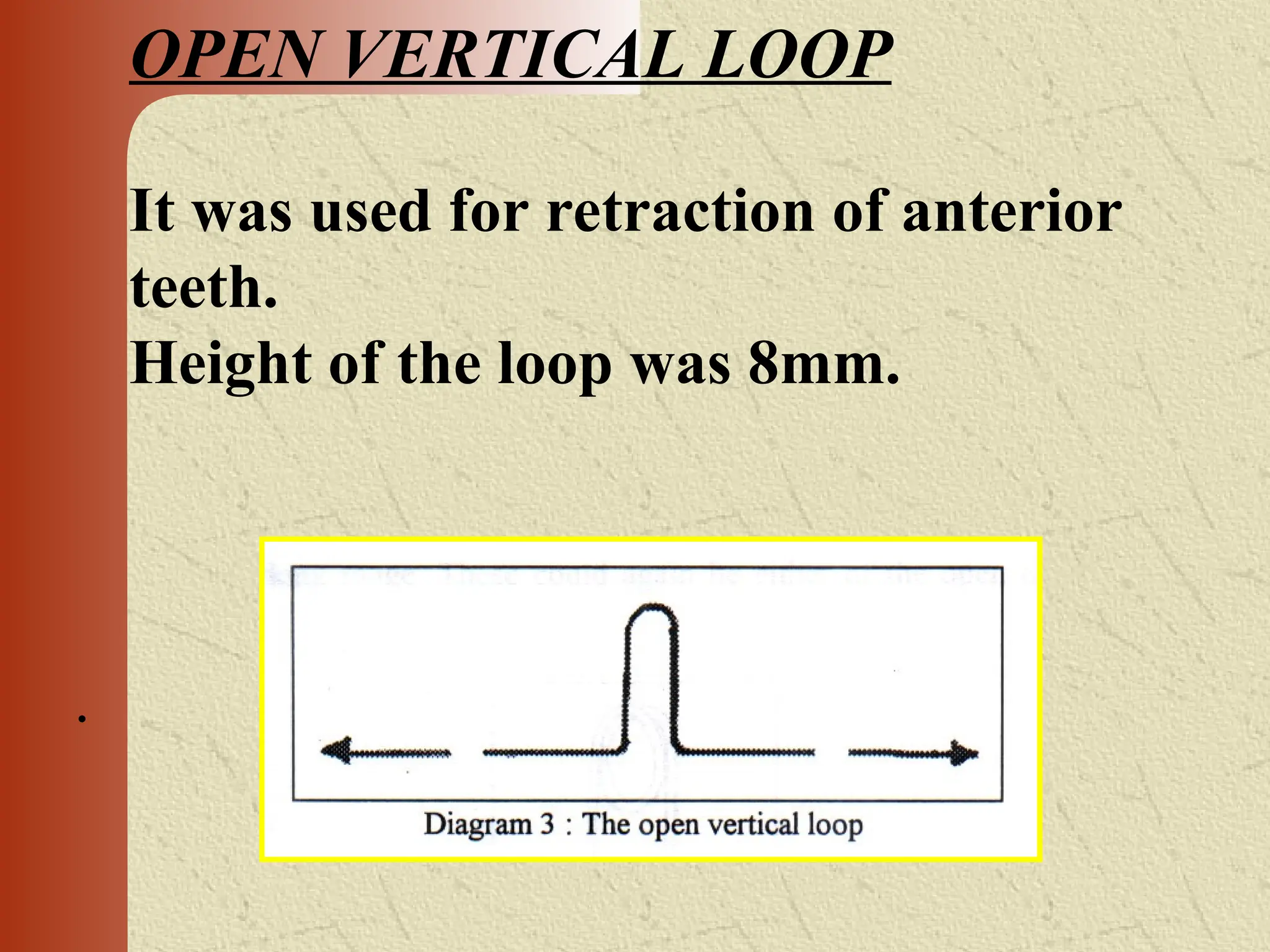 Loops in orthodontics and its uses [Autosaved]..ppt