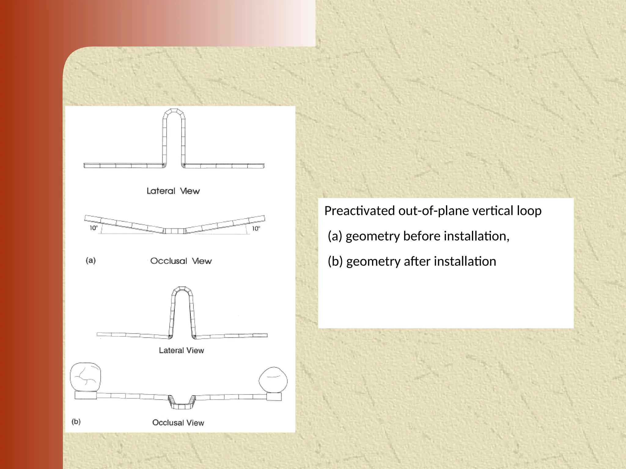 Loops in orthodontics and its uses [Autosaved]..ppt