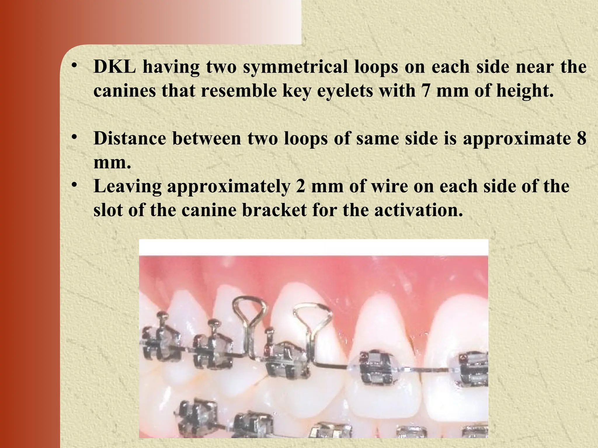 Loops in orthodontics and its uses [Autosaved]..ppt