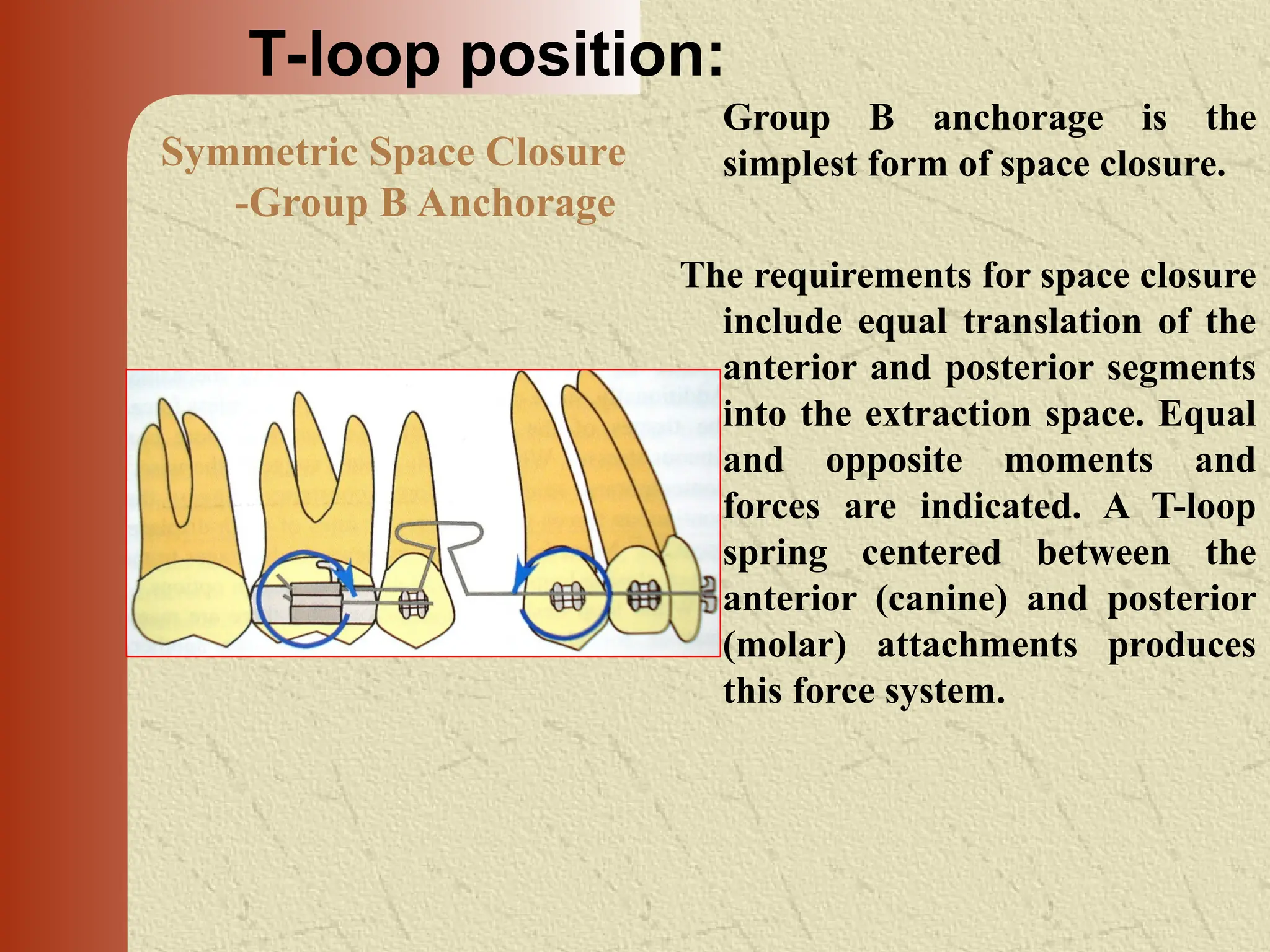 Loops in orthodontics and its uses [Autosaved]..ppt