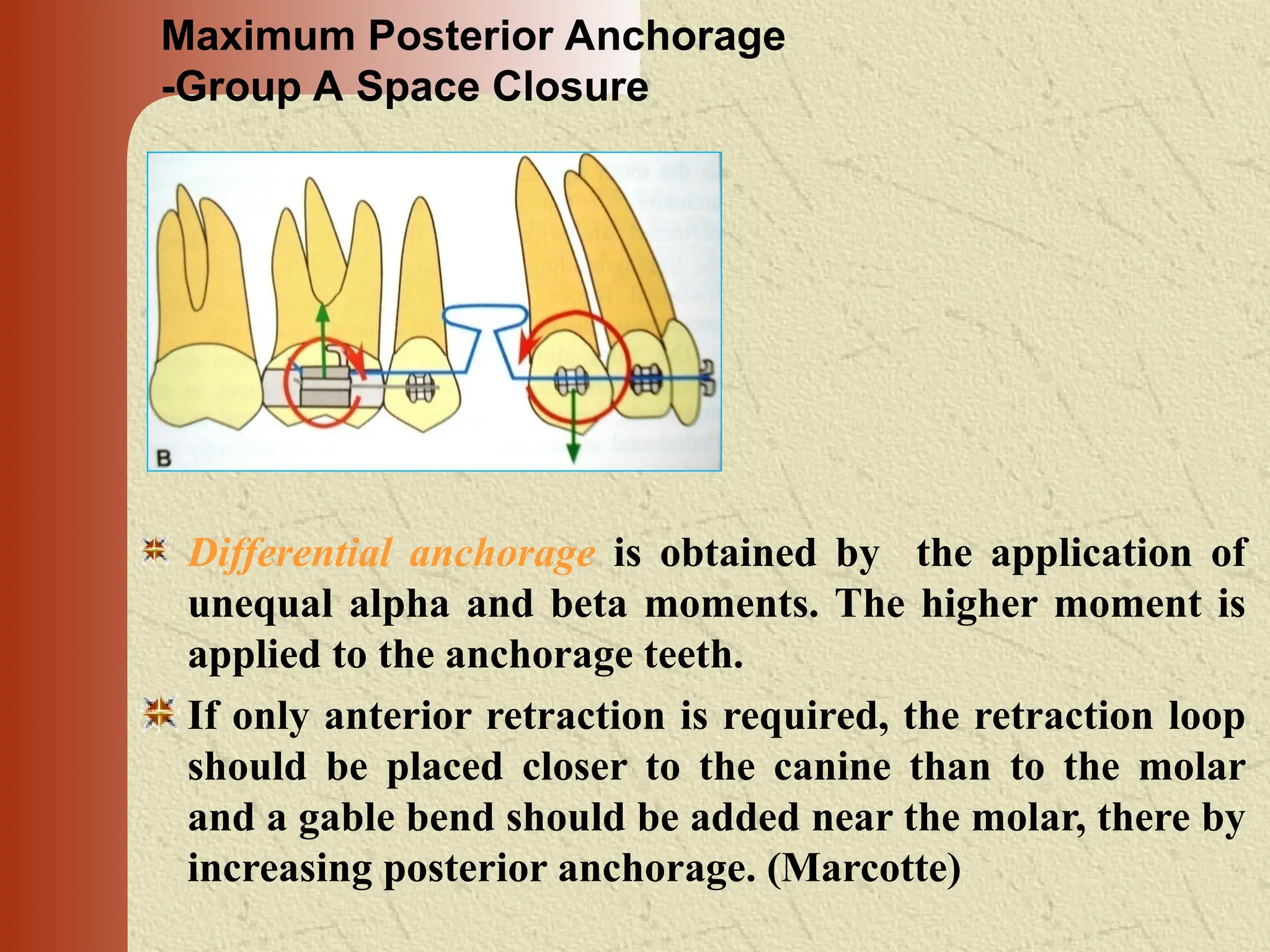 Loops in orthodontics and its uses [Autosaved]..ppt