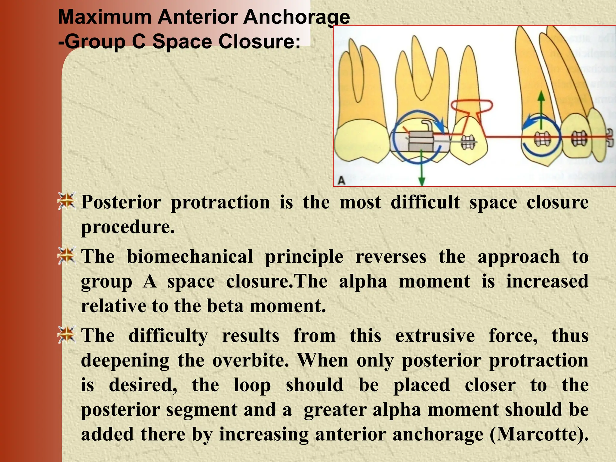 Loops in orthodontics and its uses [Autosaved]..ppt