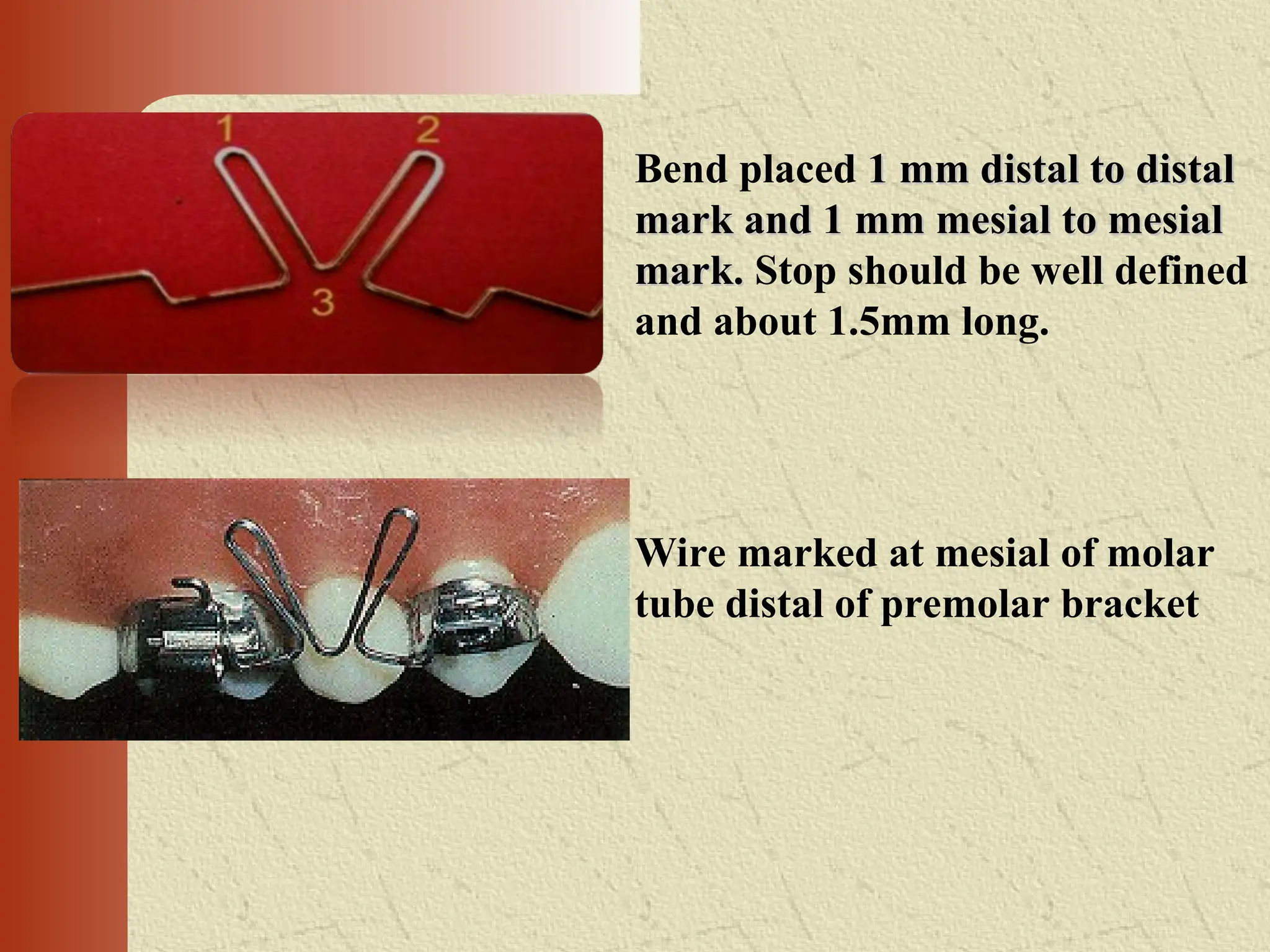 Loops in orthodontics and its uses [Autosaved]..ppt