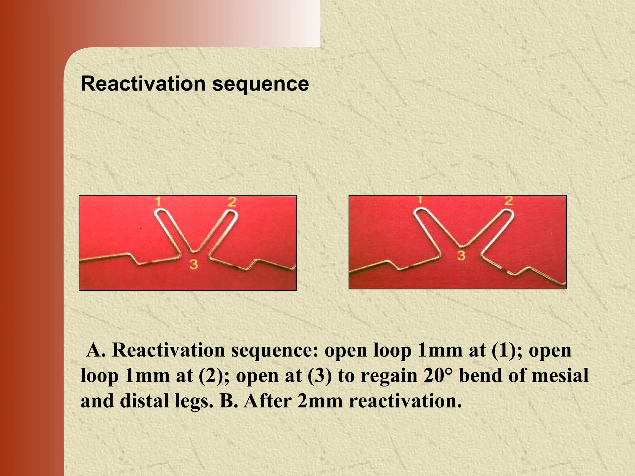 Loops in orthodontics and its uses [Autosaved]..ppt