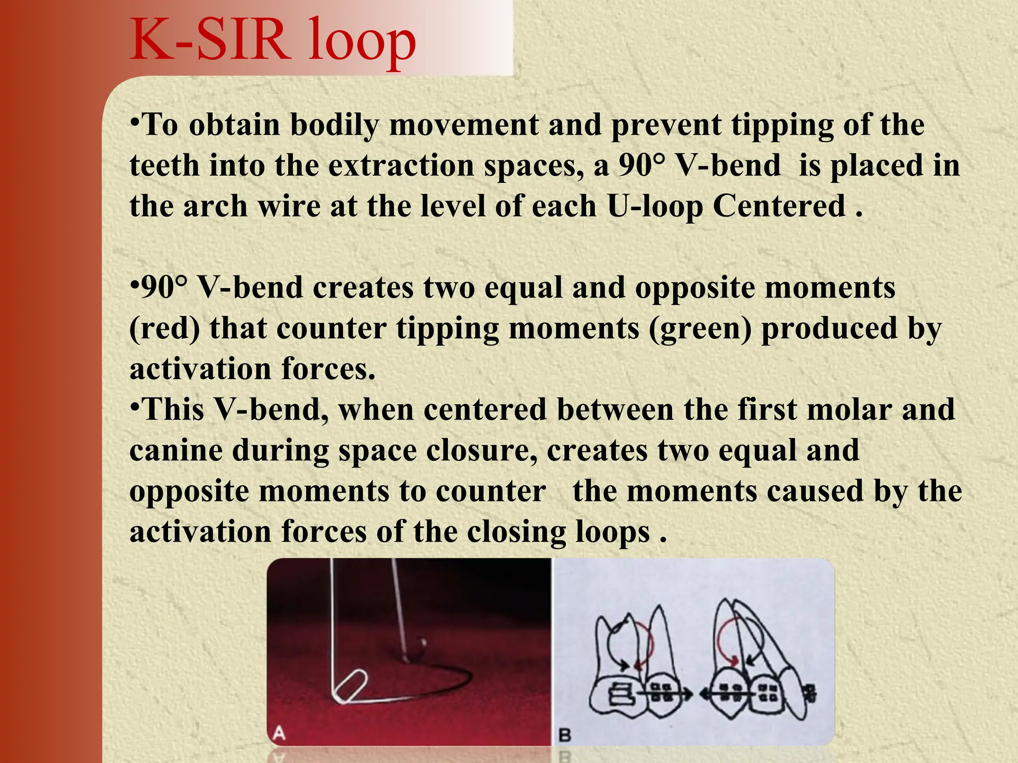Loops in orthodontics and its uses [Autosaved]..ppt