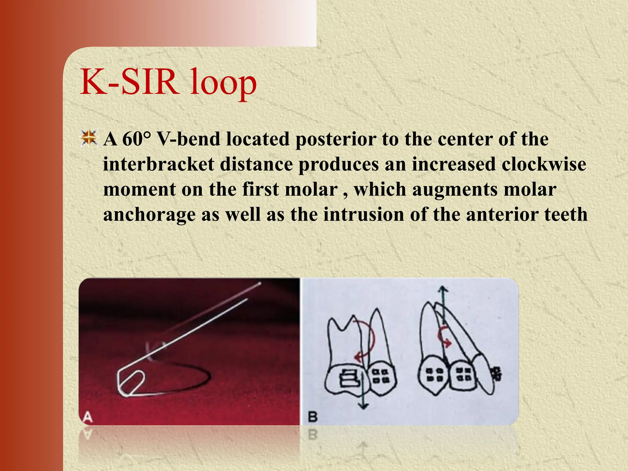 Loops in orthodontics and its uses [Autosaved]..ppt