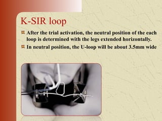 Loops in orthodontics and its uses [Autosaved]..ppt