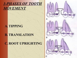 Loops in orthodontics and its uses [Autosaved]..ppt