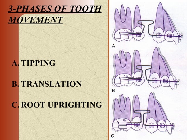 Loops in orthodontics and its uses [Autosaved]..ppt