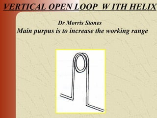 Loops in orthodontics and its uses [Autosaved]..ppt