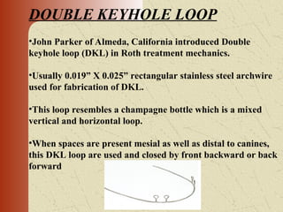 Loops in orthodontics and its uses [Autosaved]..ppt