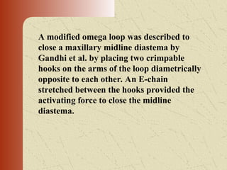 Loops in orthodontics and its uses [Autosaved]..ppt