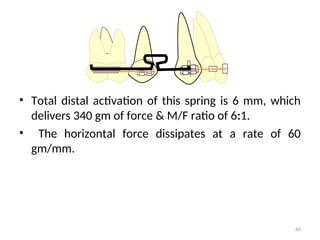 Loops in orthodontics and its uses [Autosaved]..ppt
