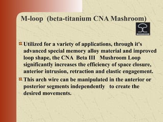 Loops in orthodontics and its uses [Autosaved]..ppt