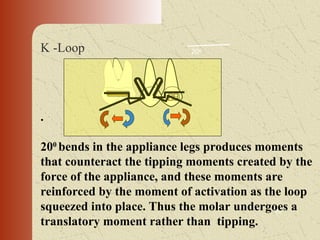 Loops in orthodontics and its uses [Autosaved]..ppt