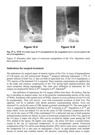 Loops Kinks and Anomalies of Vertebral Arteries | PDF
