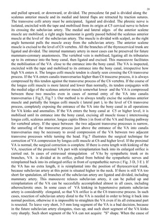 Loops Kinks and Anomalies of Vertebral Arteries | PDF
