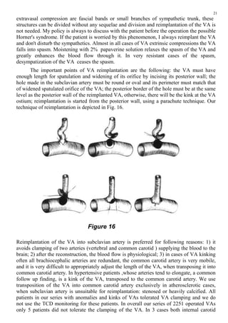 Loops Kinks and Anomalies of Vertebral Arteries | PDF