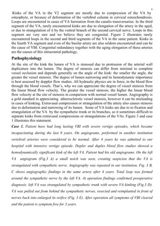 Loops Kinks and Anomalies of Vertebral Arteries | PDF
