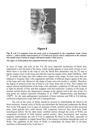 Loops Kinks and Anomalies of Vertebral Arteries | PDF