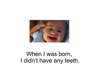 Loose Teeth Ppt