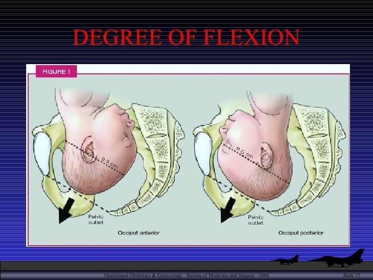 poor progress of labour