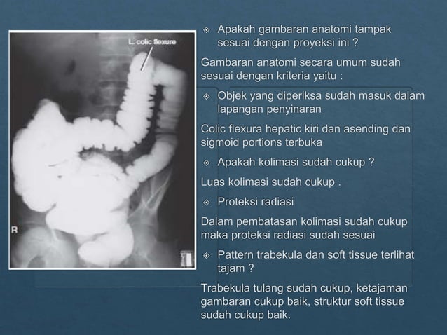 ppt kritisi dan evaluasi radiograf Lopografi