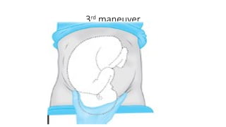 LOPOLD'S MANOEUVERS.pptx best of obs and gyn | PPTX