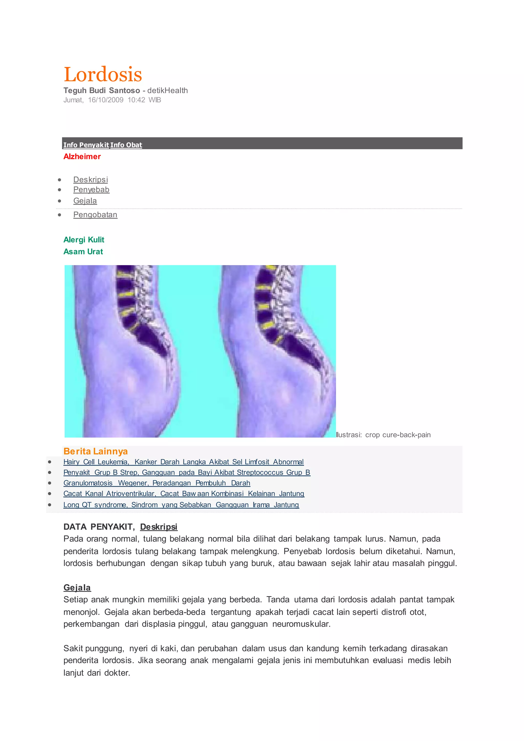 Lordosis | PDF