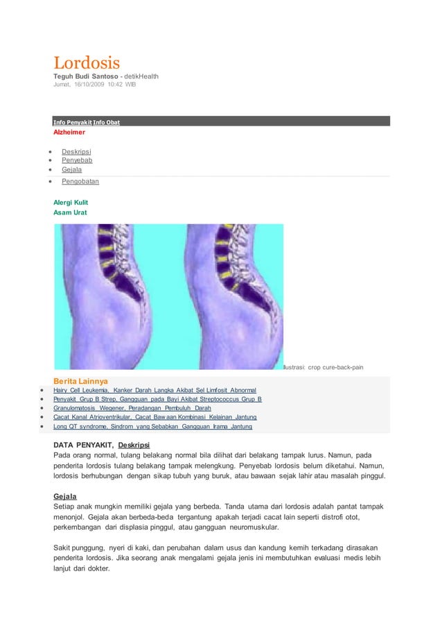 Lordosis | DOCX