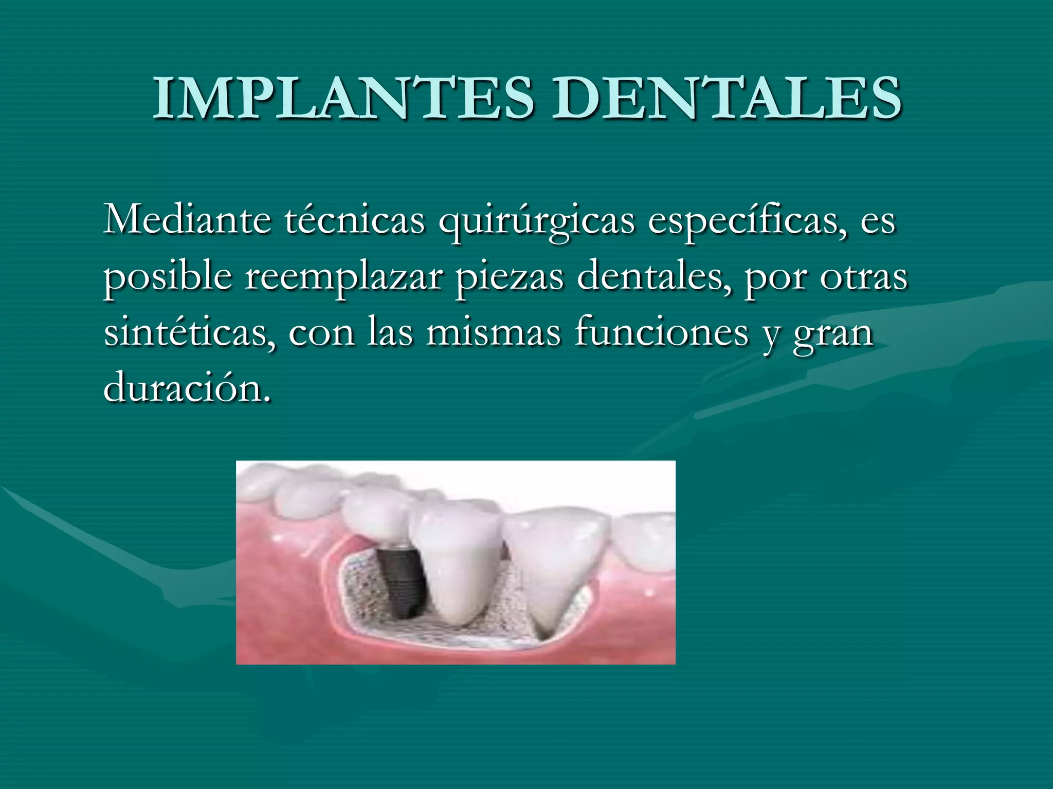 Los biomateriales | PPT