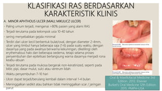 Reccurent Aphthous Stomatitis (RAS) / Stomatitis Aftosa Rekuren | PPTX