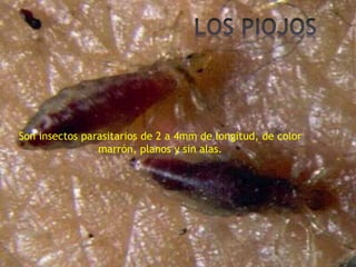 Los piojos | PPTX