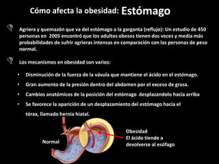 Los problemas ocultos de la obesidad | PPSX