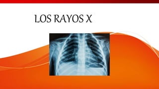 LOS RAYOS X.pptx todo sobre debemos conocer | PPTX