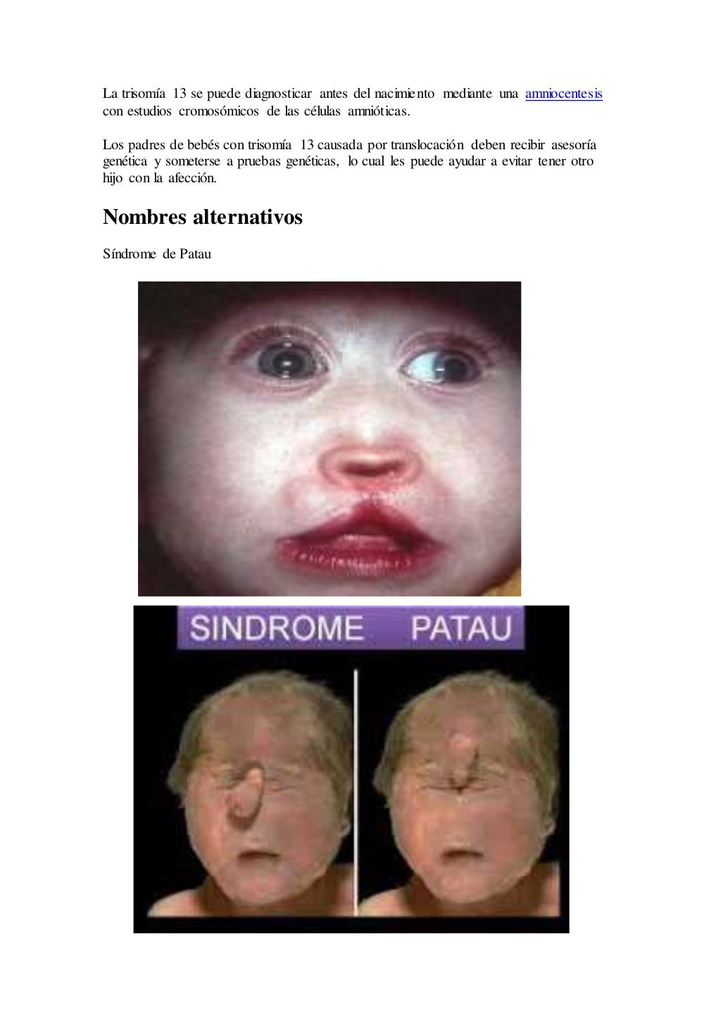 Los sindromes mas comunes